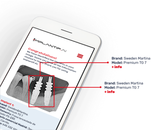 Implantif.ai - Your dental implant identification assistant